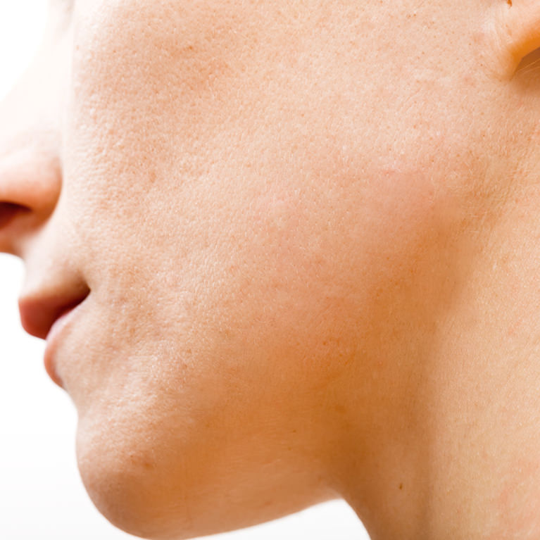5 Easy Ways to Remove Blemishes - PHLEARN